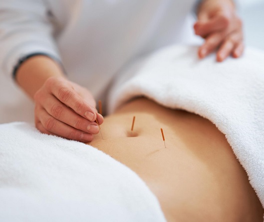 IVF is Strongly Enhanced by Acupuncture – SATORY – The inner, Intuitive ...